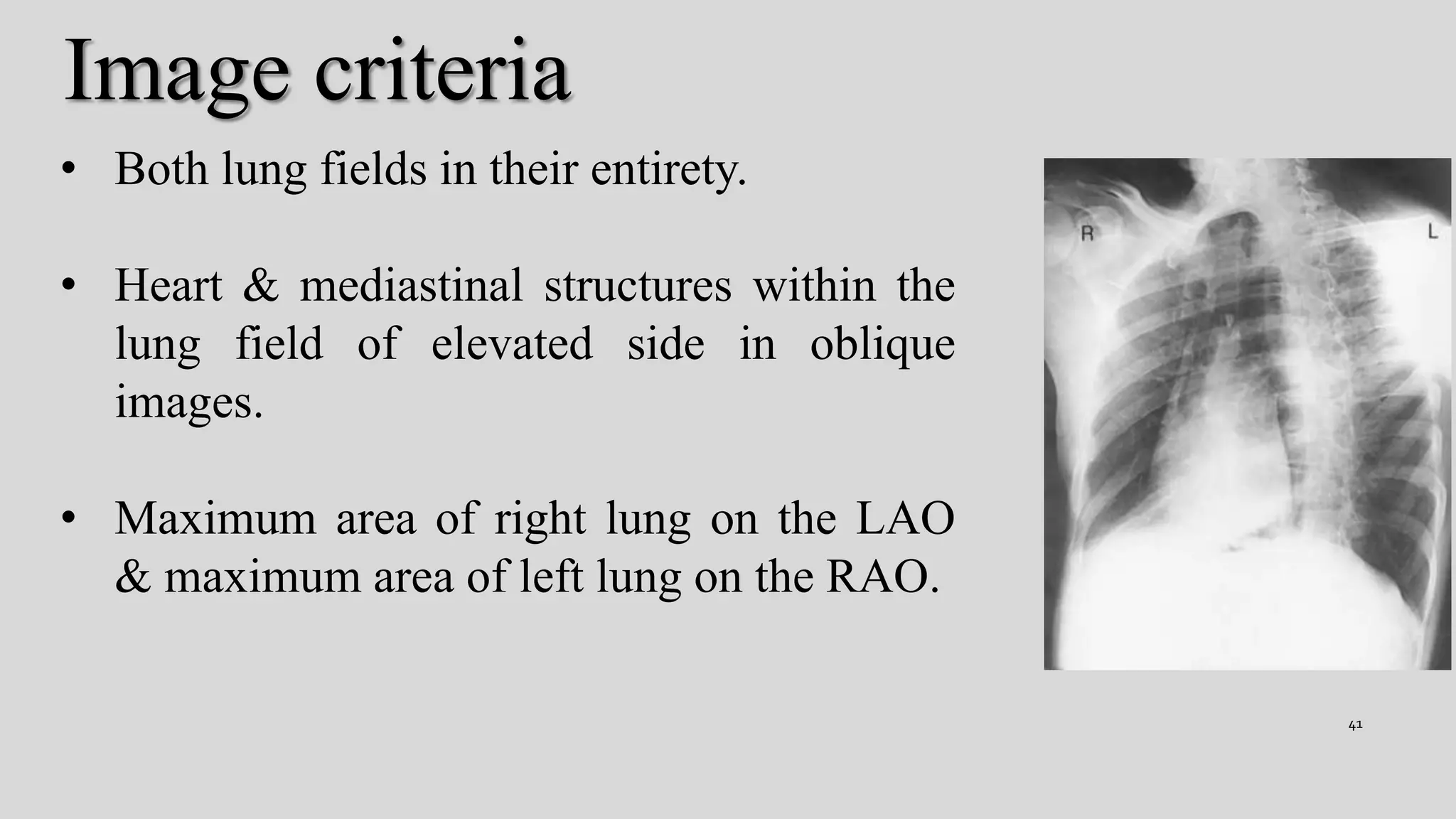 Presentation2.pptx technique chest 2 | PPT