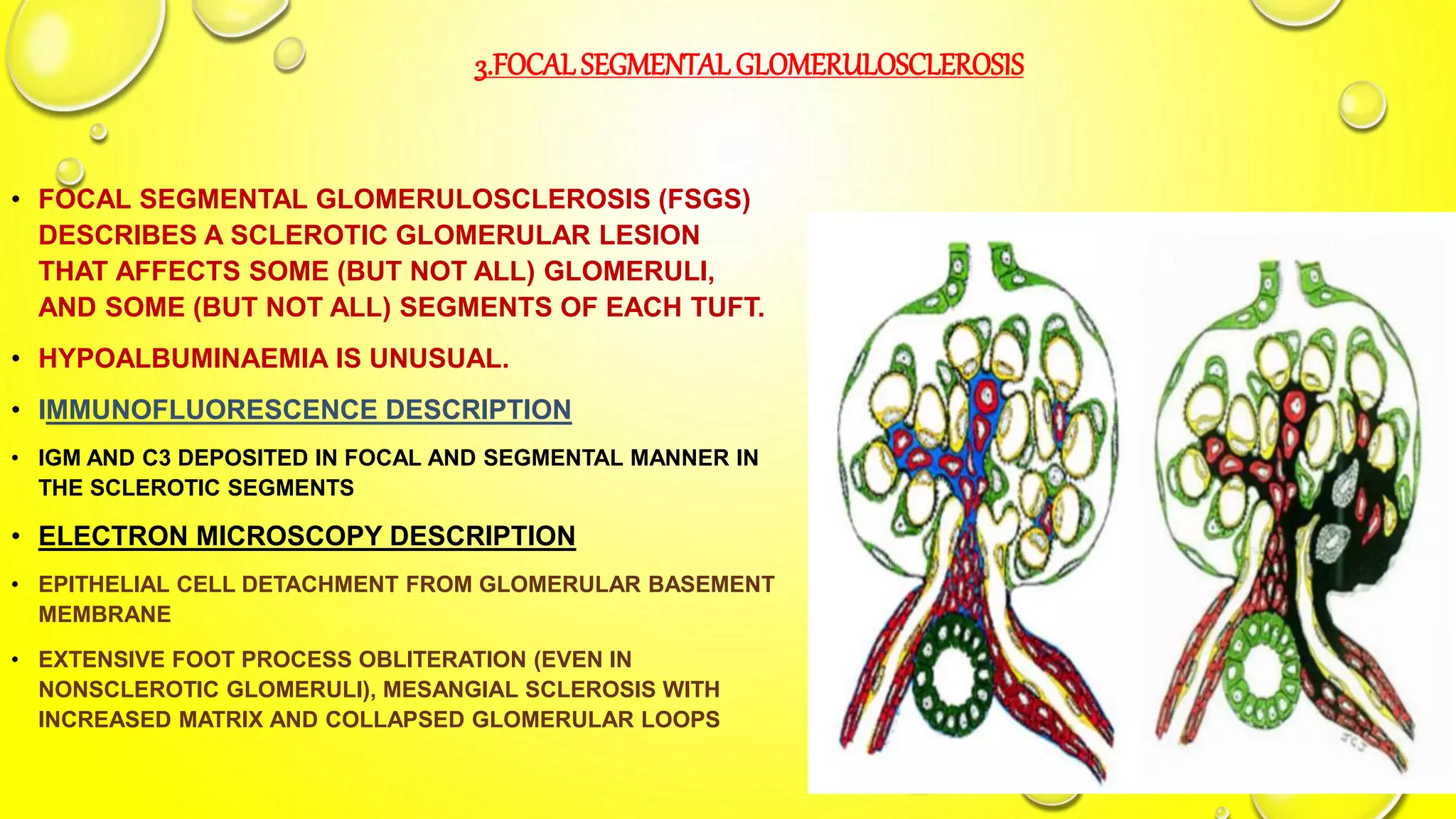 nephrotic and nephritic syndrome | PPTX