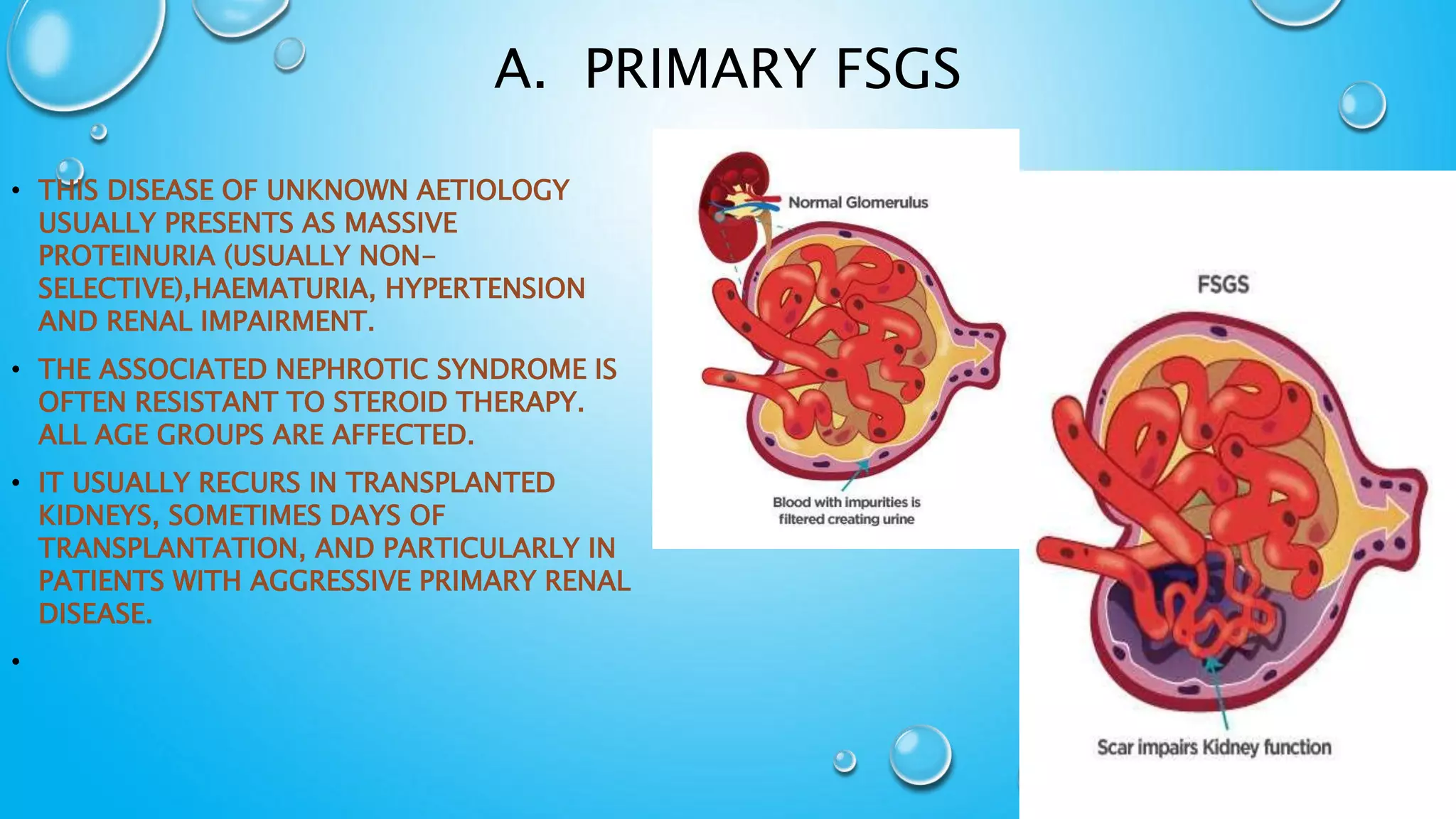 nephrotic and nephritic syndrome | PPTX