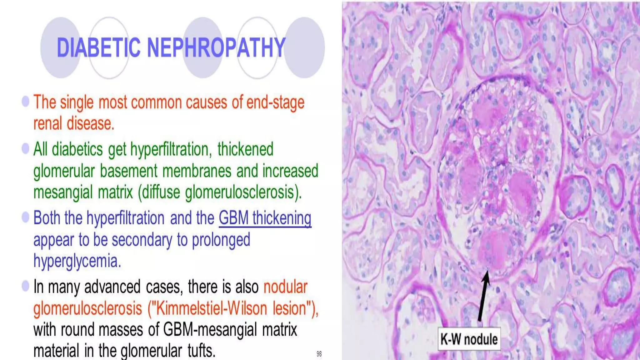 nephrotic and nephritic syndrome | PPTX