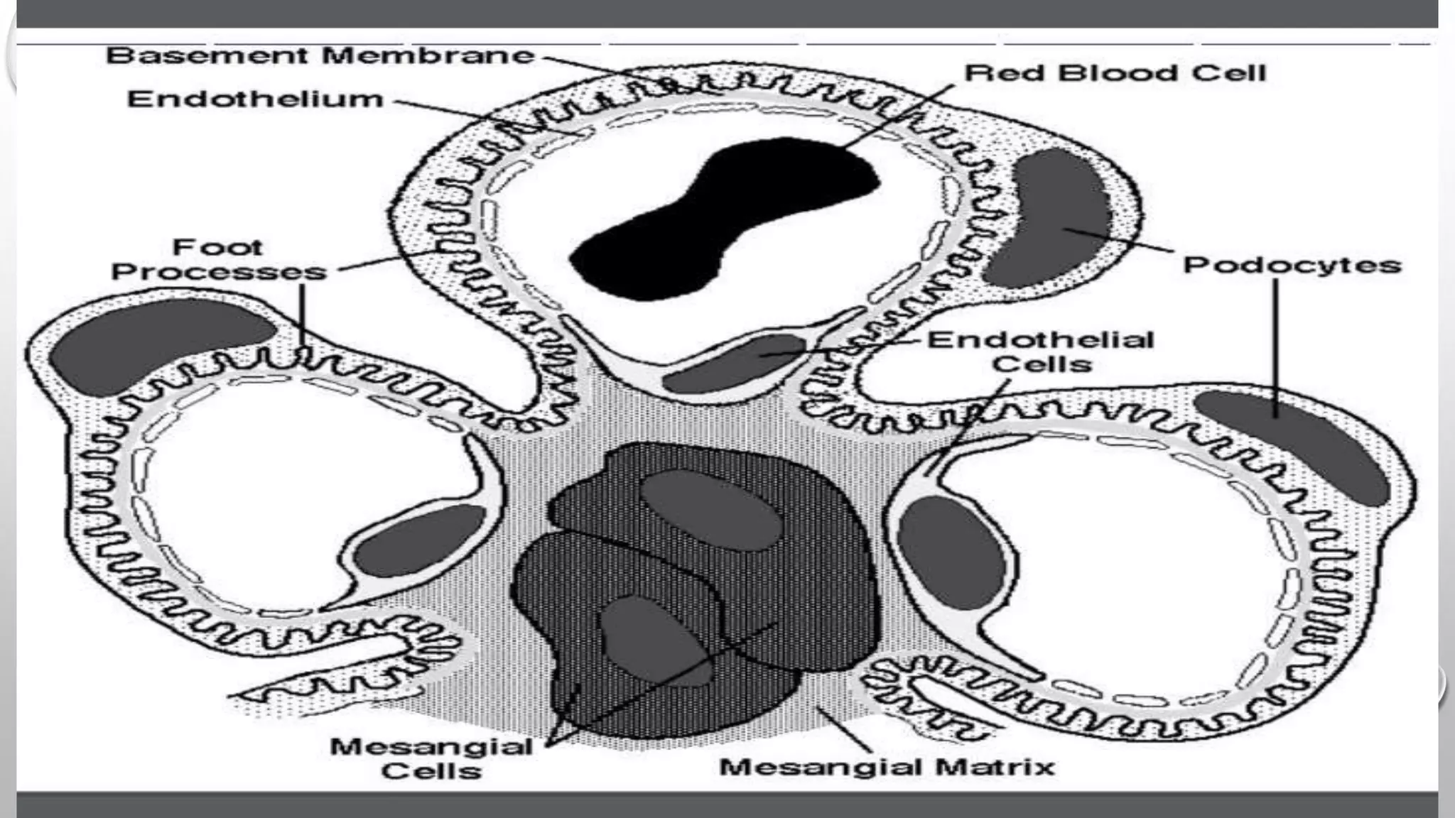 nephrotic and nephritic syndrome | PPTX