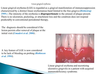 Linear Gingival Erythema