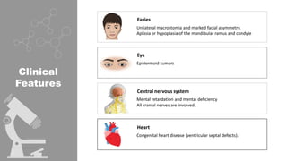 Goldenhar syndrome | PPTX
