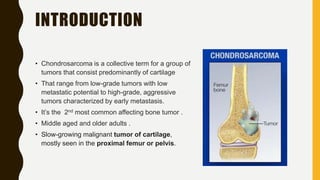 Chondrosarcoma | PPTX