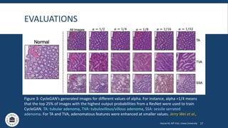 Medical Image Data Augmentation using GANs | PPTX