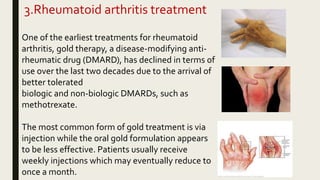 all the aspects of gold in medical purposes / gold uses in medicine | PPT