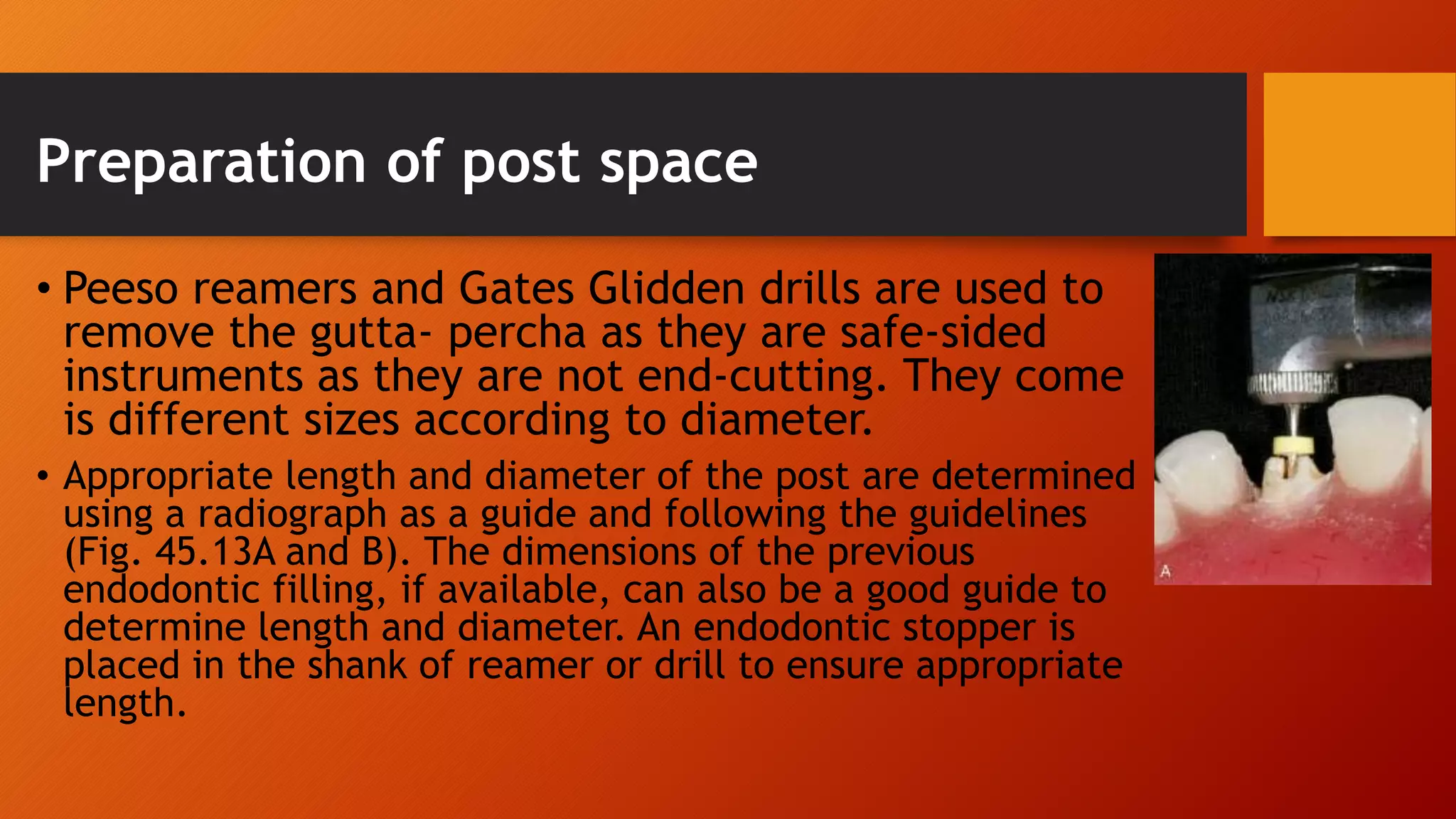 restoration of endodontically treated teeth in prosthodontics/ post and ...