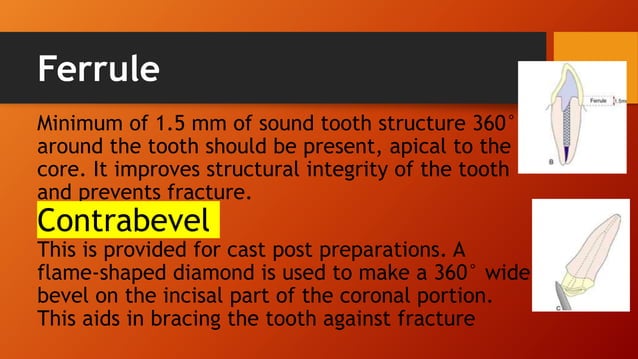 restoration of endodontically treated teeth in prosthodontics/ post and ...