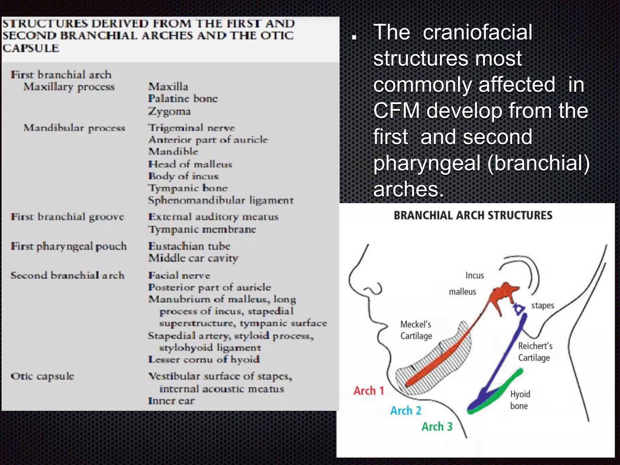 craniofacial microsomia | PPTX