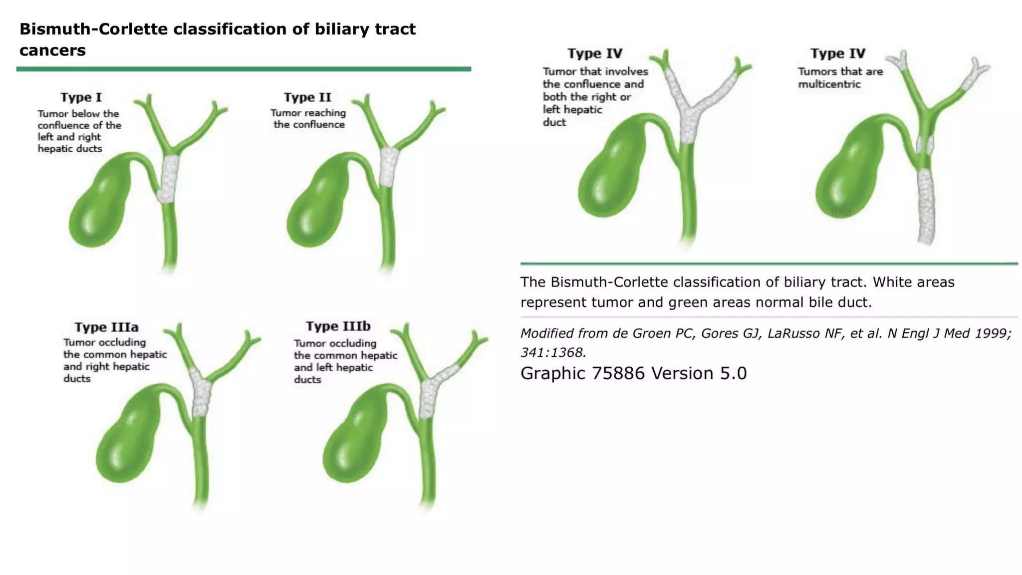 CHOLANGIOCARCINOMA- BILE DUCT CANCER | PPTX