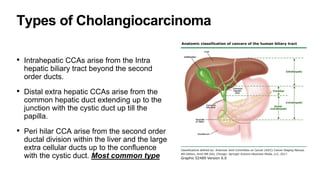 CHOLANGIOCARCINOMA- BILE DUCT CANCER | PPTX