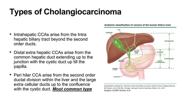CHOLANGIOCARCINOMA- BILE DUCT CANCER | PPTX | Digestive Disorders ...