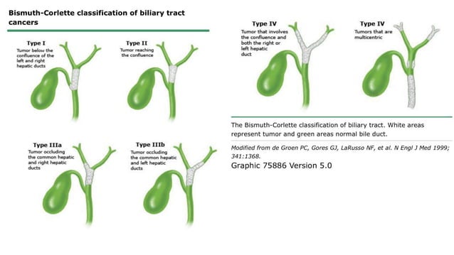 CHOLANGIOCARCINOMA- BILE DUCT CANCER | PPTX | Digestive Disorders | Diseases and Conditions