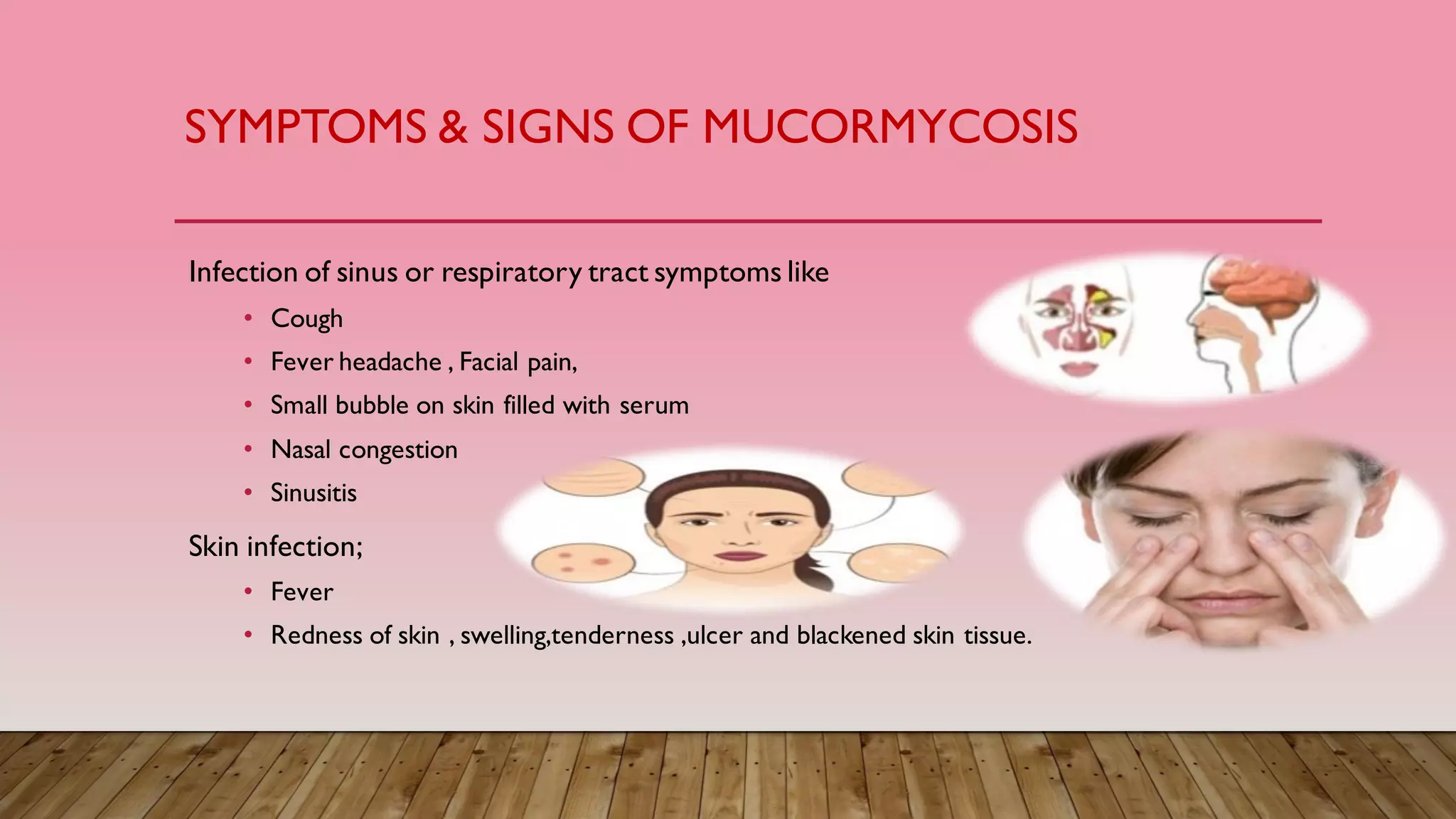 Mucormycosis or Black fungus | PDF
