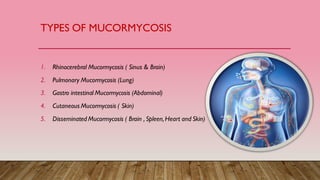 Mucormycosis or Black fungus | PDF