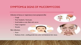 Mucormycosis or Black fungus | PDF