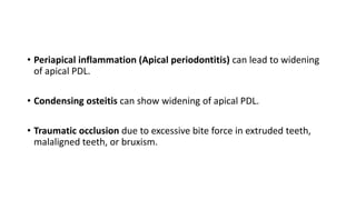 widening of PDL | PPTX