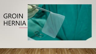 Groin hernia .pptx