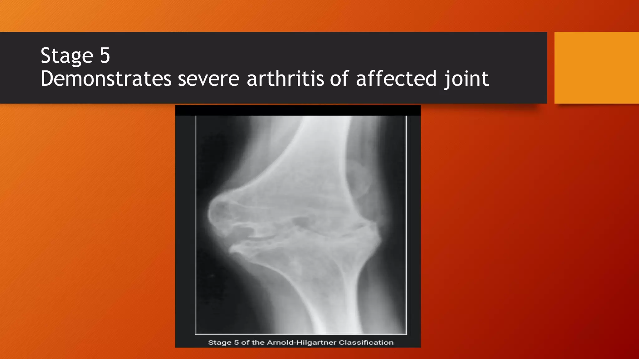 Hemophilic arthritis.pdf
