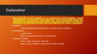 Hemophilic arthritis.pdf