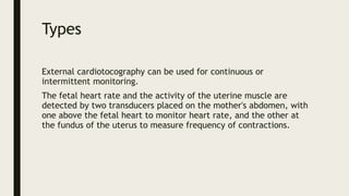 ctd pregnancy | PPTX
