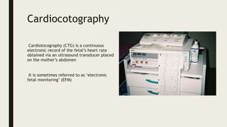 ctd pregnancy | PPTX