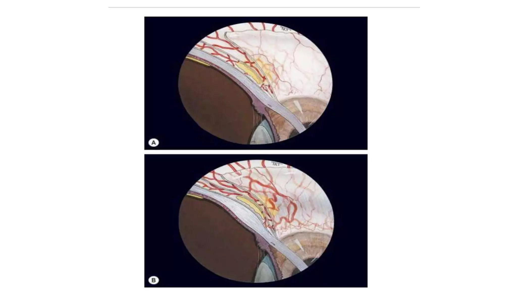 Scleritis.pptx | Eye and Vision Conditions | Diseases and Conditions
