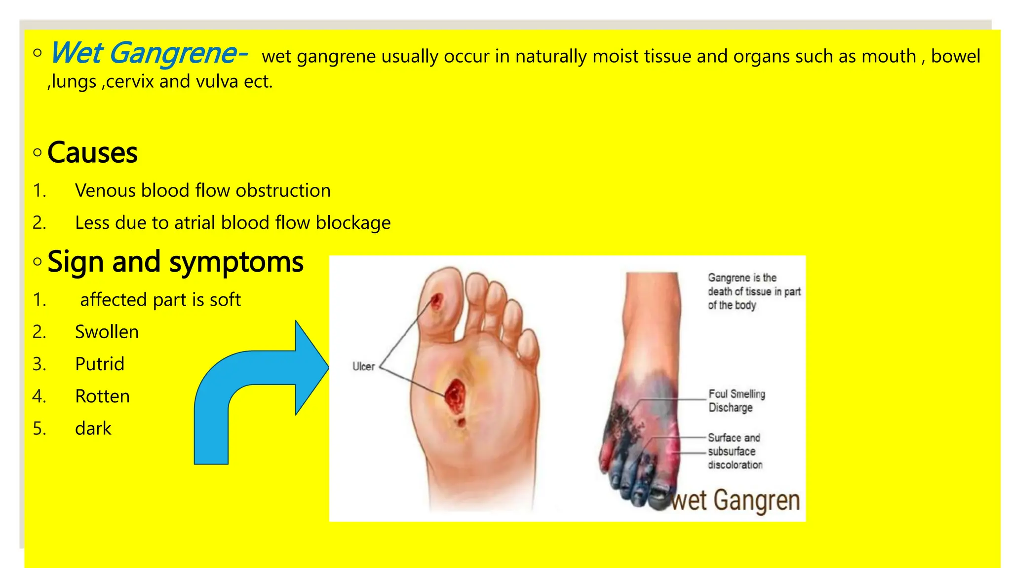 Pathology Gangrene | PPTX
