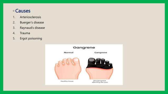 Pathology Gangrene | PPTX | Blood Disorders | Diseases and Conditions