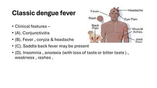 Dengue fever | PPT