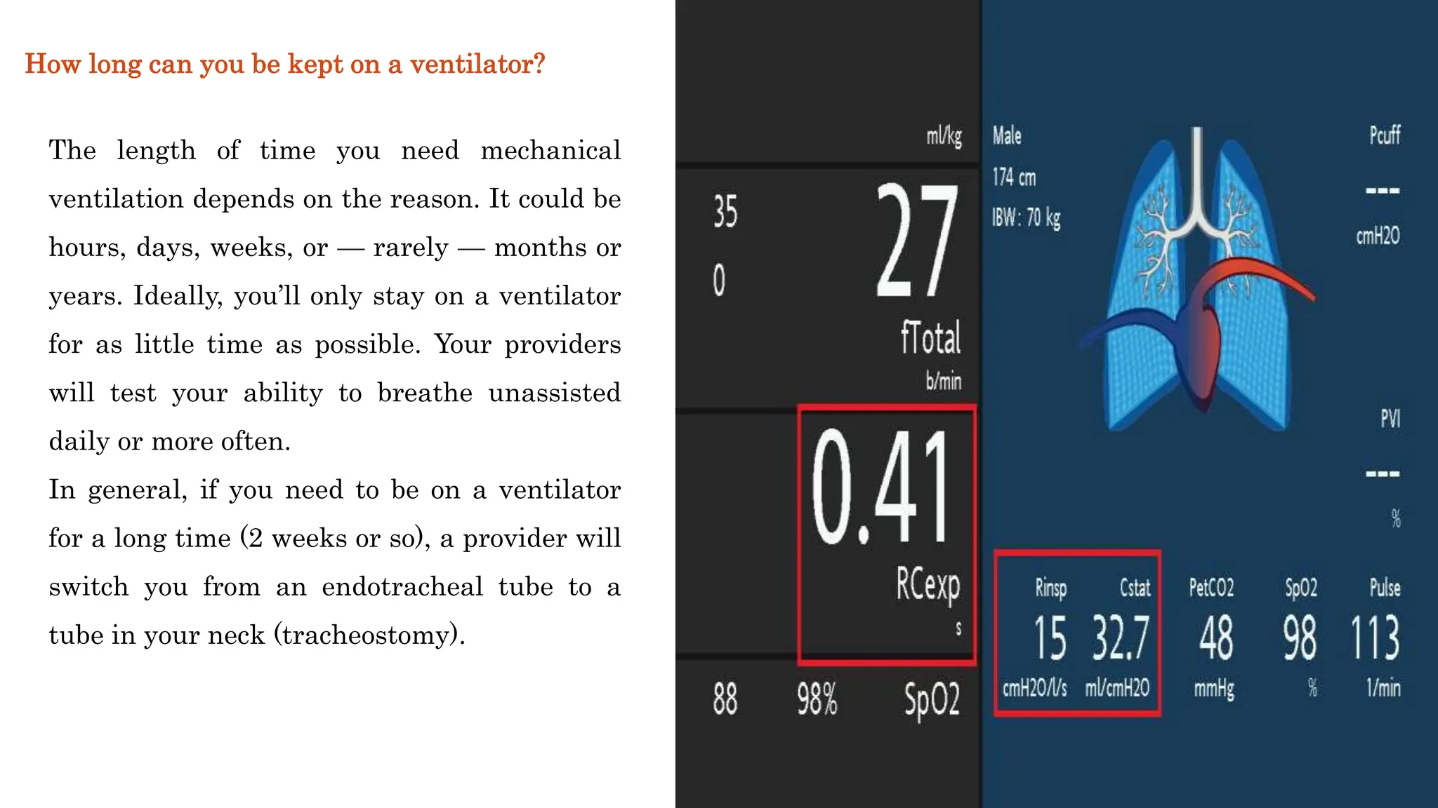 The Pulmonary system - Artificial organ 2.pptx