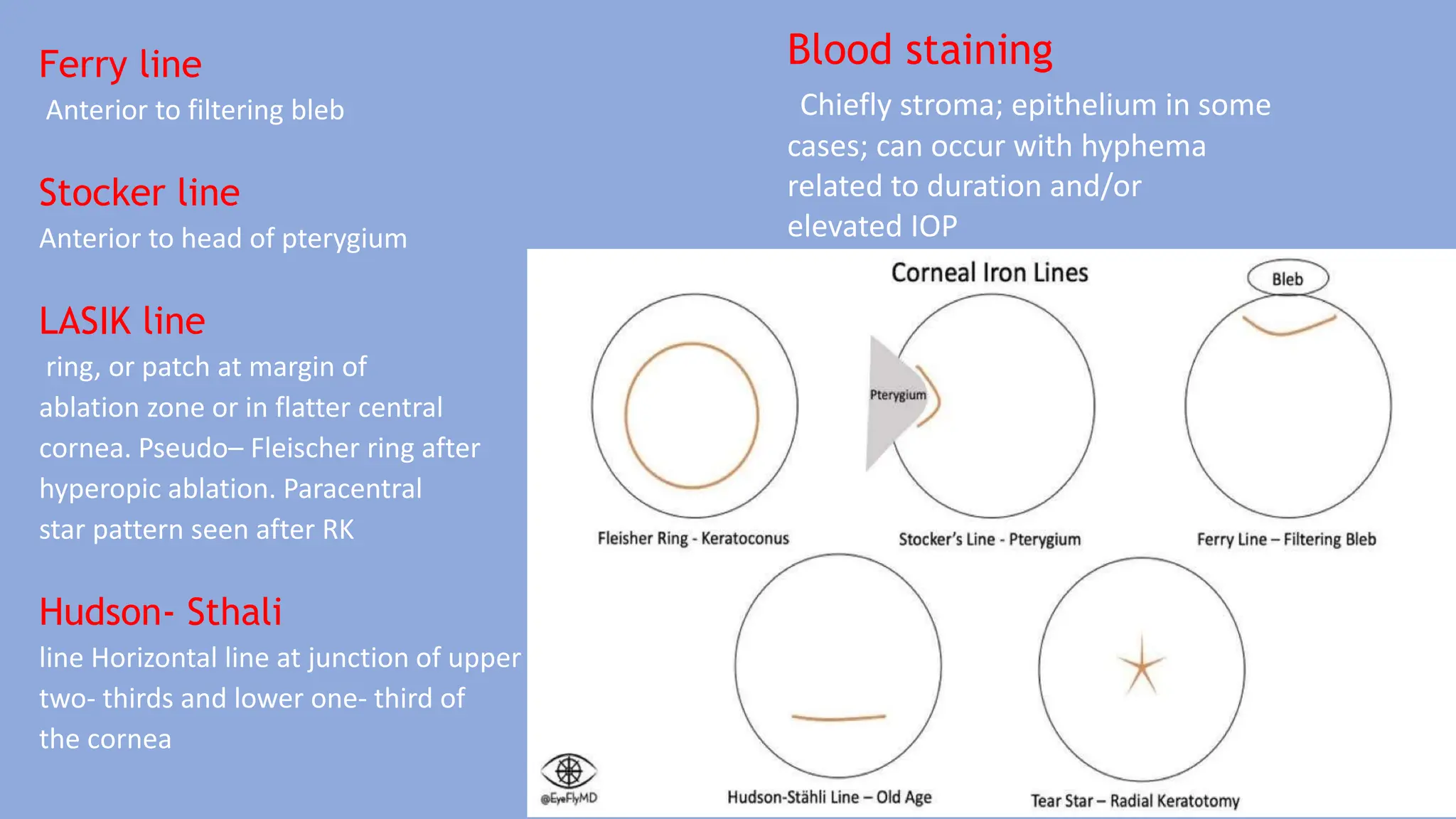 Corneal degeneration and corneal deposition | PPT