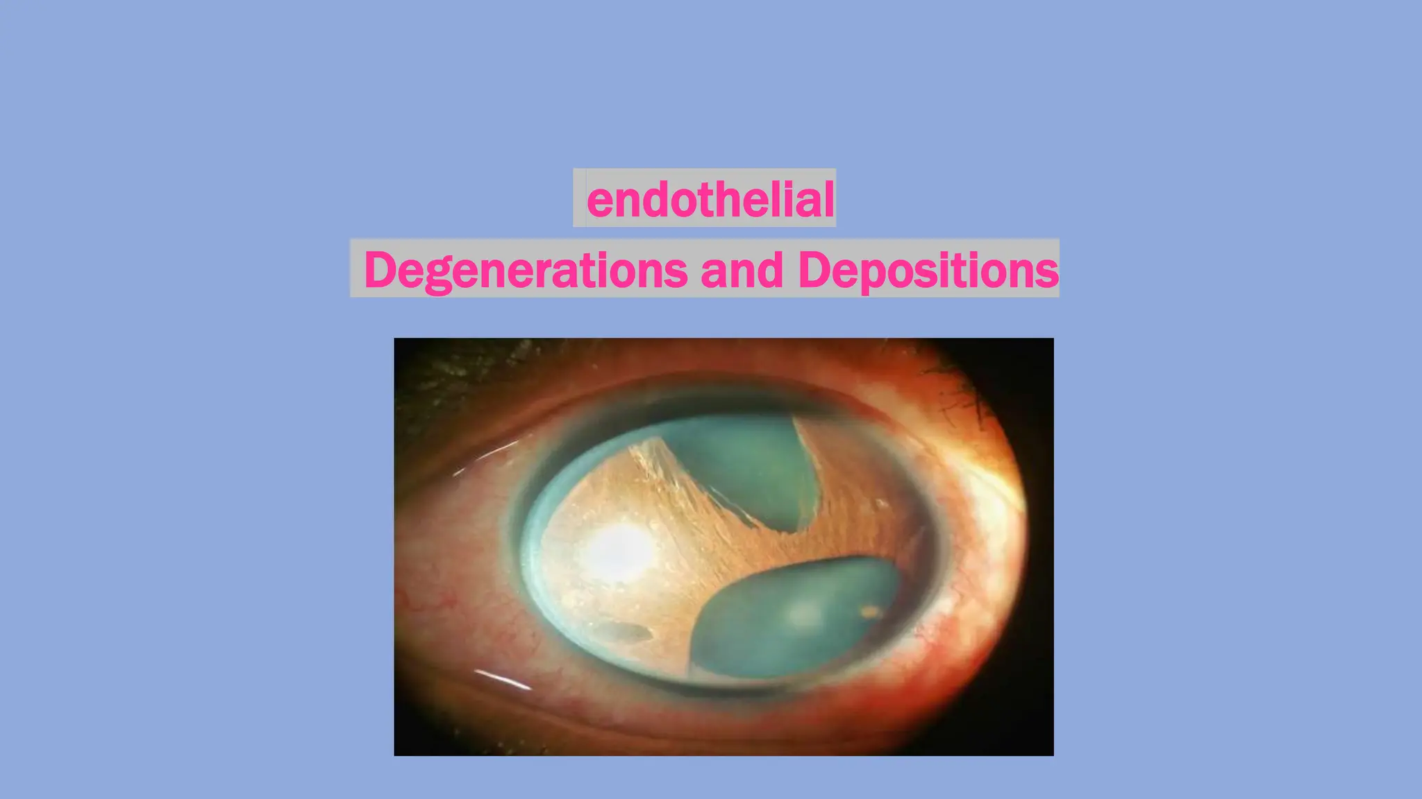 Corneal degeneration and corneal deposition | PPT
