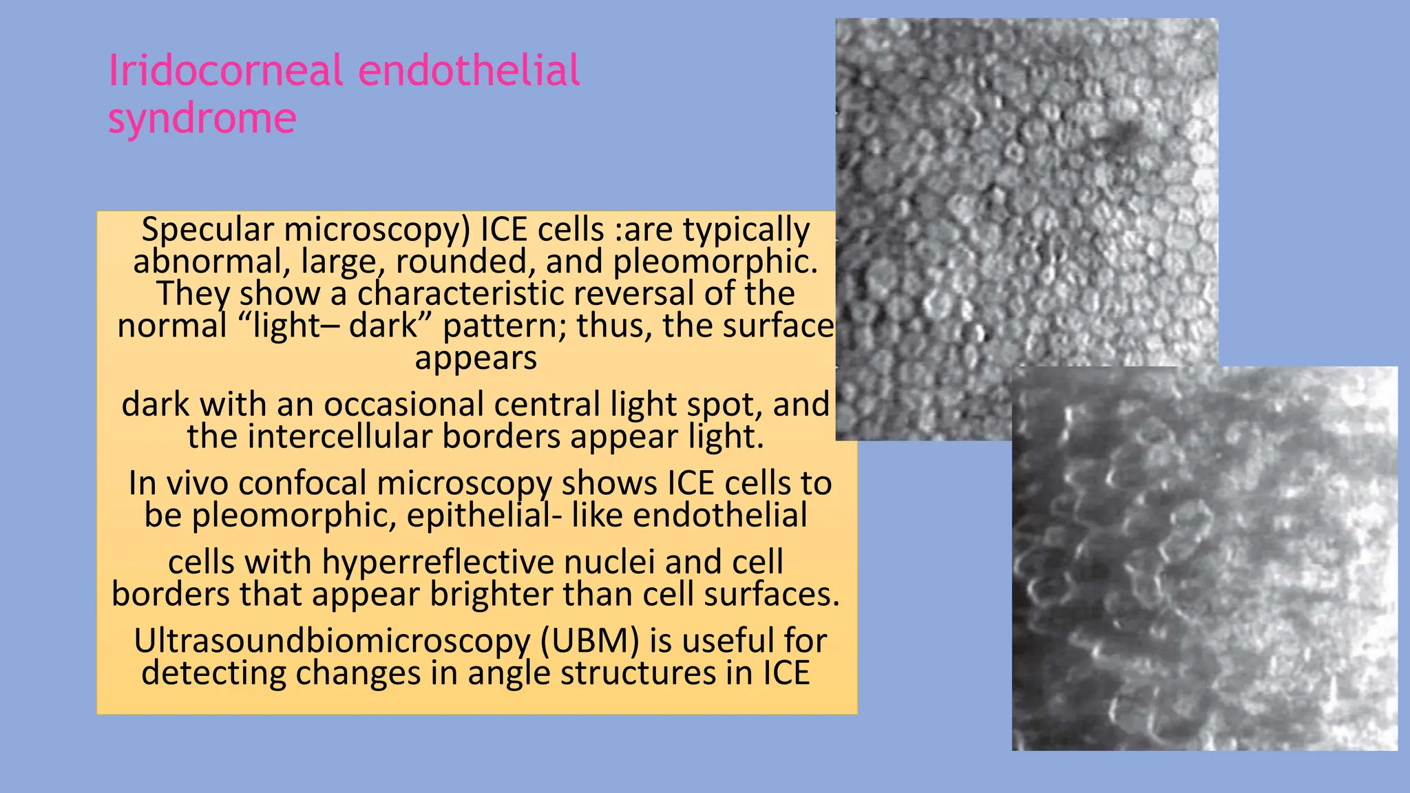 Corneal degeneration and corneal deposition | PPT