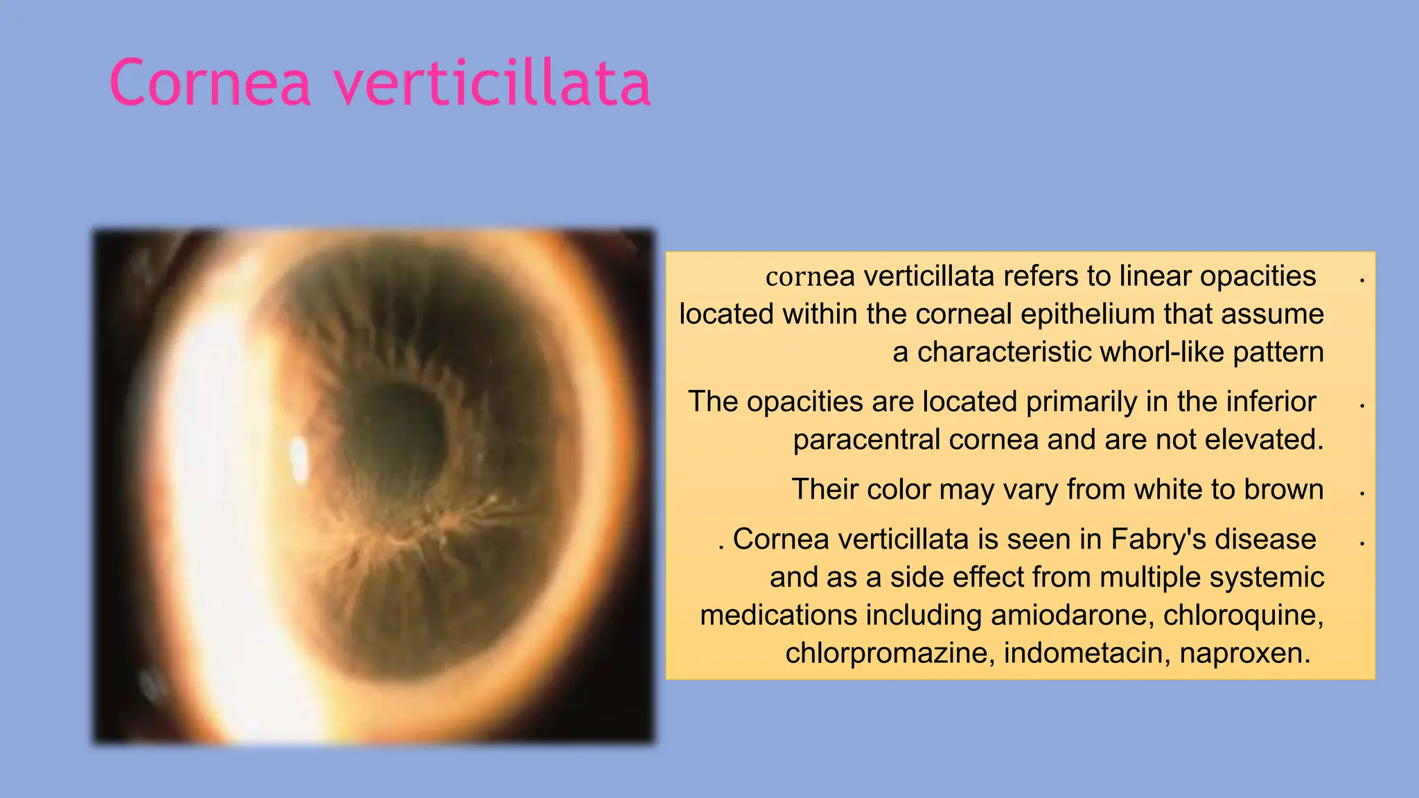 Corneal degeneration and corneal deposition | PPT
