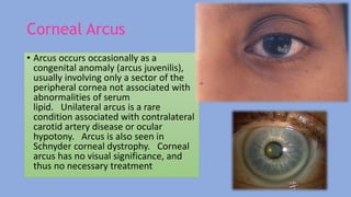 Corneal degeneration and corneal deposition | PPTX