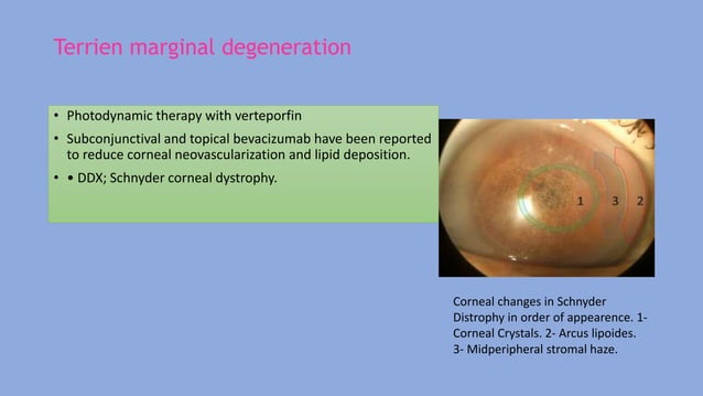 Corneal degeneration and corneal deposition | PPT
