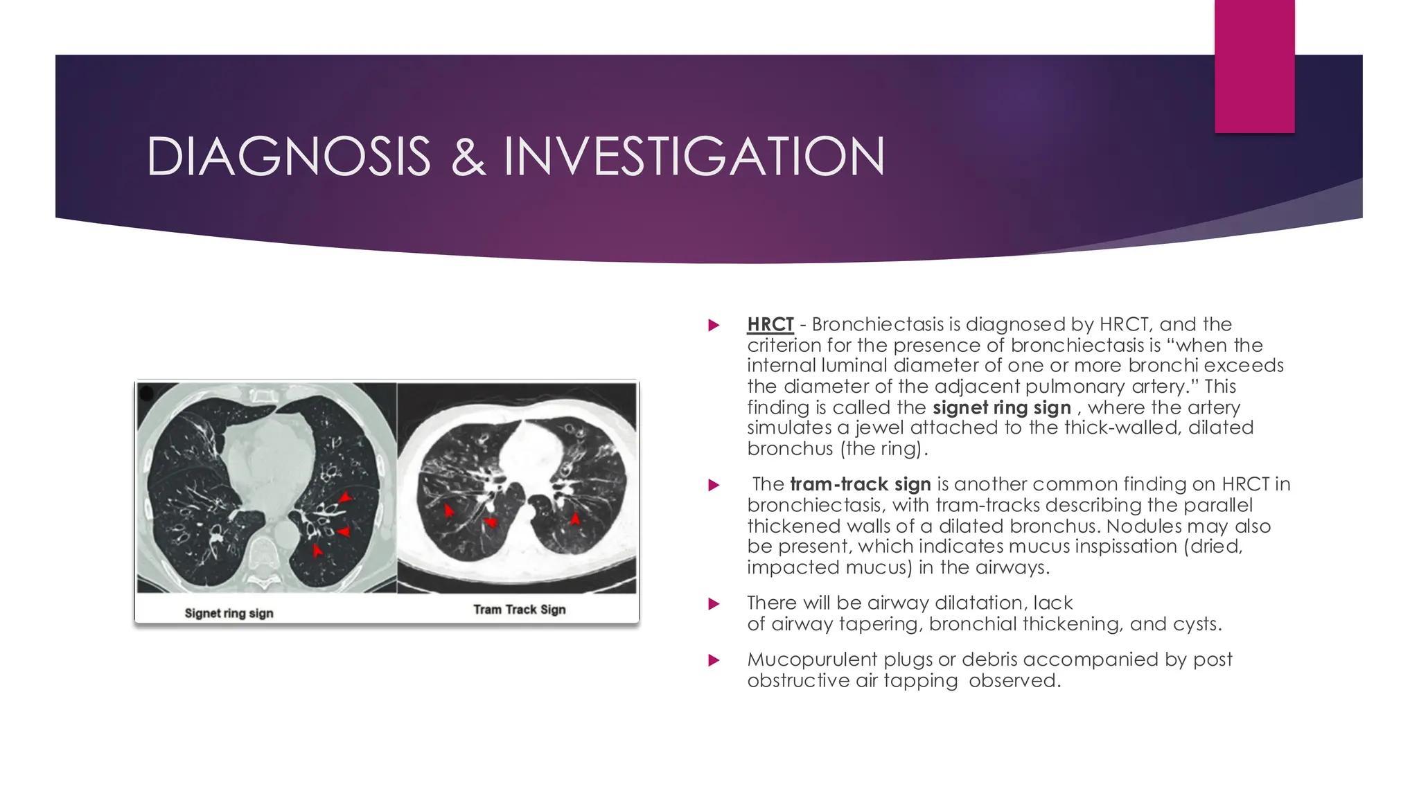 Bronchiectasis and Physiotherapy Management | PDF
