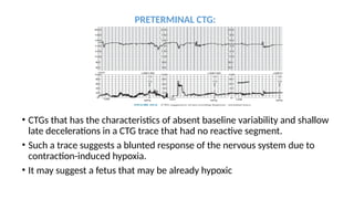 Fetal monitoring in critical care setting | PPTX