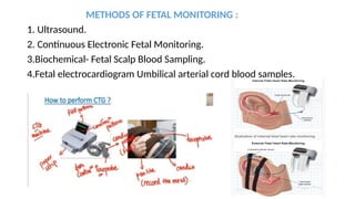 Fetal monitoring in critical care setting | PPTX