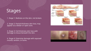 Basic life support, Cardiopulmonary resuscitation | PPT