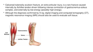 Subtalar dislocation and calcaneus fractures 2.pptx