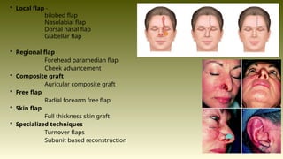 Rhinoplasty- A Comprehensive inside into nasal reconstruction .pptx