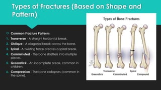 Fractures and classification , Treatment , Complications | PPTX