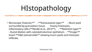 mucocele Presentation in oral dentistrys | PPTX