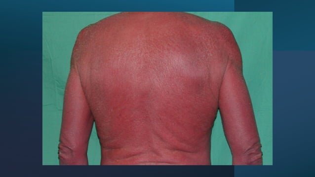 Describing Emergency conditions in Dermatology | PPT
