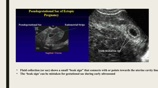 First trimester ultrasound evaluation timeline | PPTX