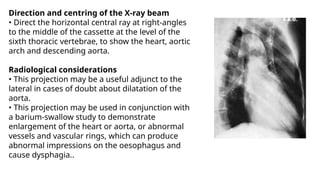 Comprehensive X-Ray Positioning Techniques for Thorax, Upper Airways ...