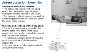 Comprehensive X-Ray Positioning Techniques for Thorax, Upper Airways ...