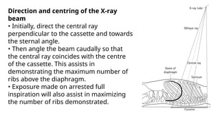 Comprehensive X-Ray Positioning Techniques for Thorax, Upper Airways ...